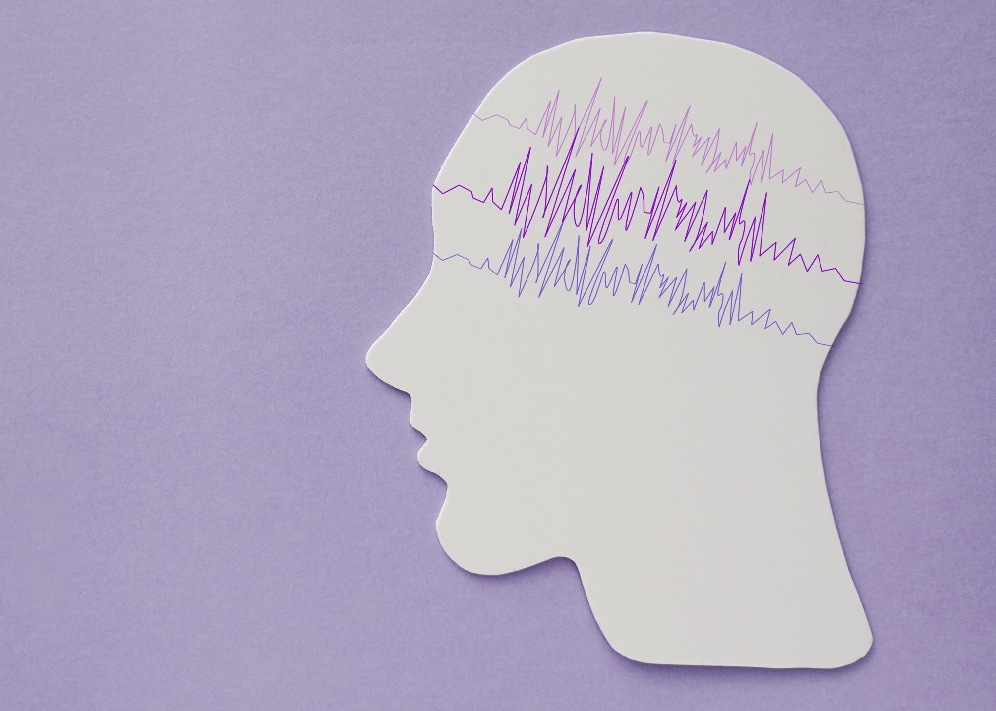 Νέα θεραπεία για την επιληψία με βλαστοκύτταρα